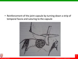 Subluxation and dislocation of temporomandibular joint | PPTX