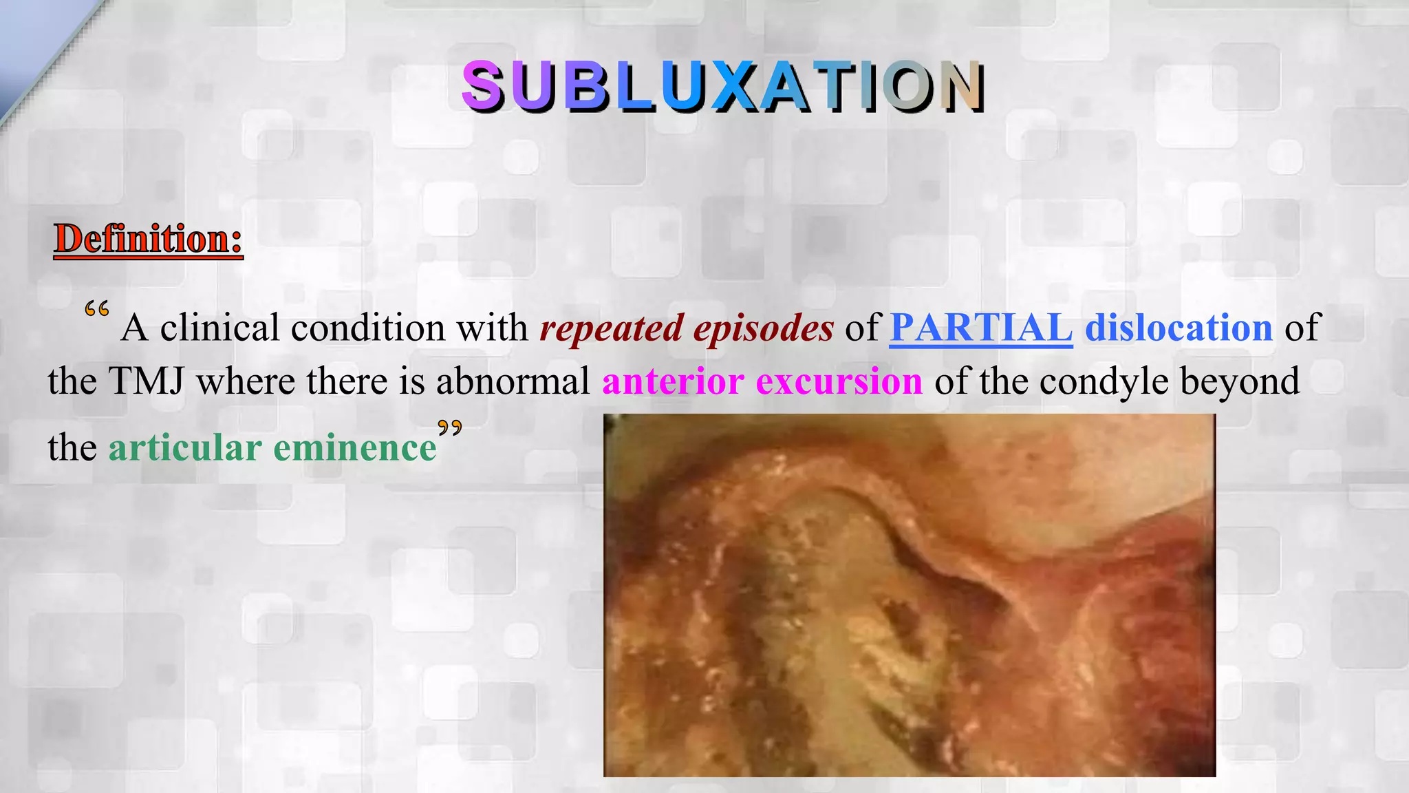 Subluxation (TMJ disorder) | PPSX