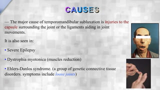 Subluxation (TMJ disorder) | PPSX
