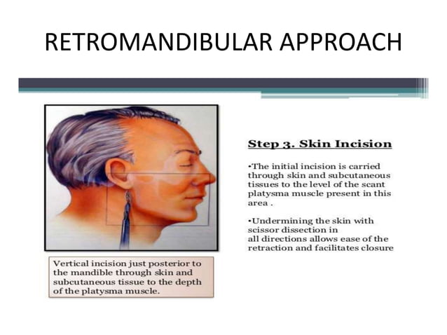 Submandibular and retromandibular approach | PPTX