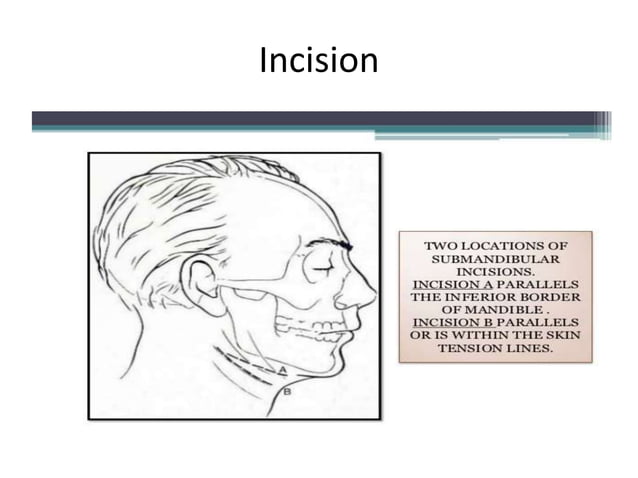 Submandibular and retromandibular approach | PPTX