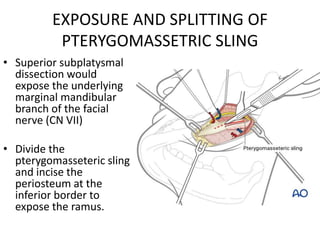 SUBMANDIBULAR APPROACH PPT for mandibular fractures.pptx
