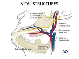 SUBMANDIBULAR APPROACH PPT for mandibular fractures.pptx