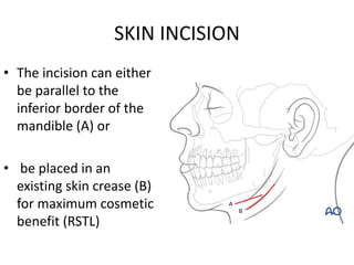 SUBMANDIBULAR APPROACH PPT for mandibular fractures.pptx