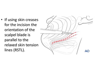 SUBMANDIBULAR APPROACH PPT for mandibular fractures.pptx