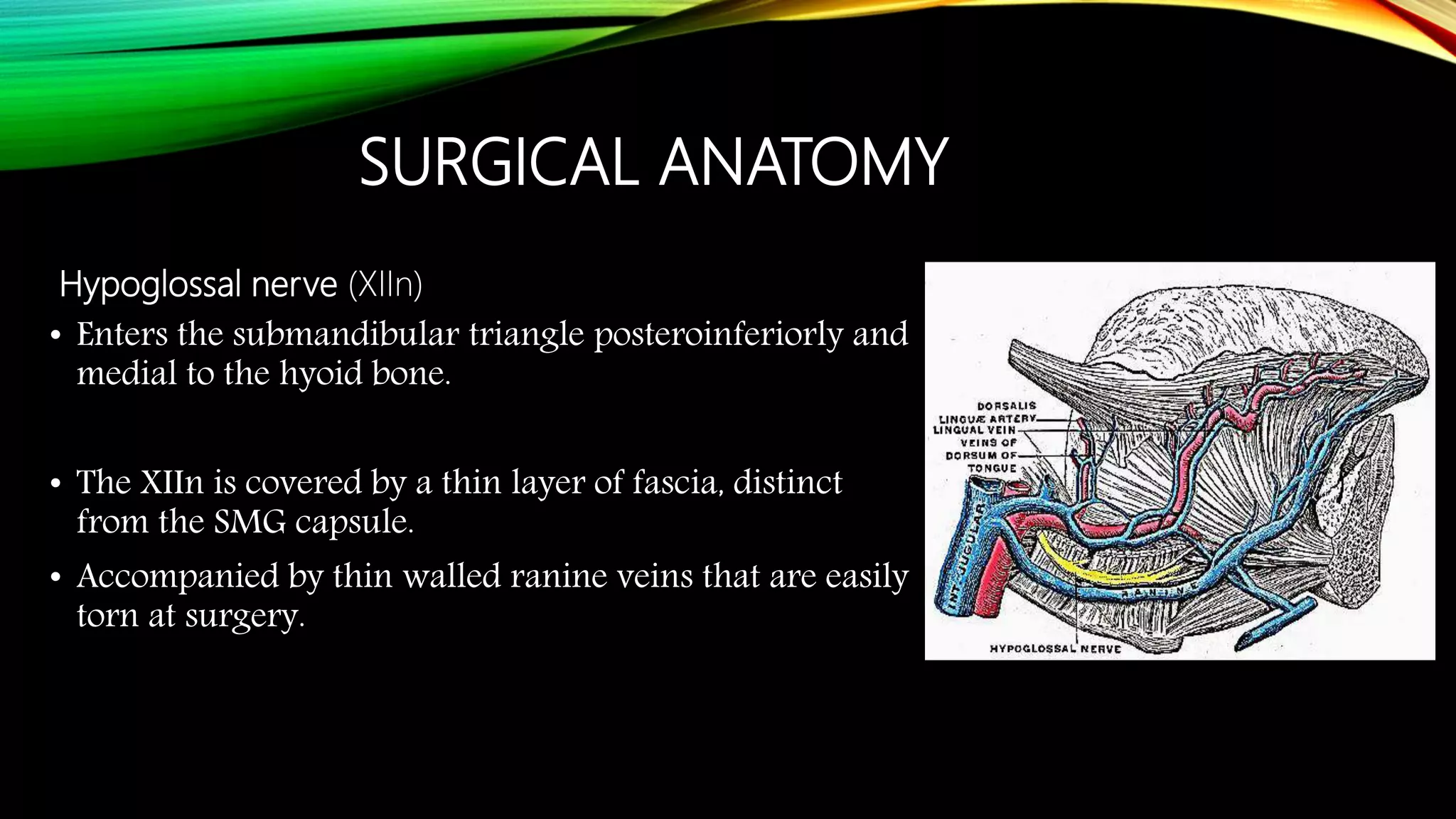 Submandibular gland excision | PPTX
