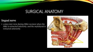 Submandibular Gland Excision