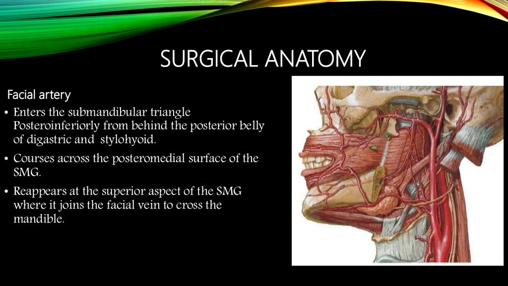 Submandibular gland excision