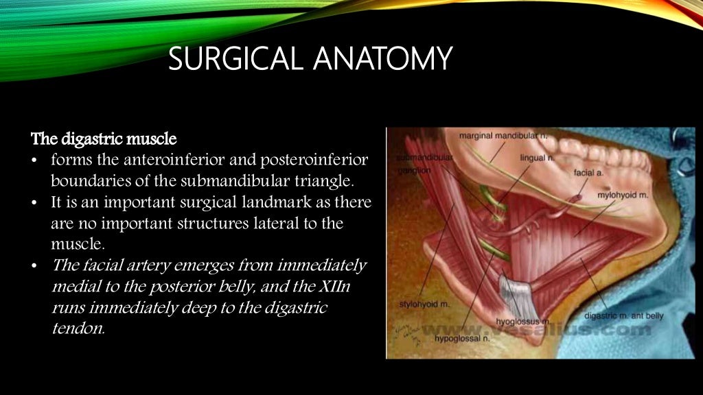 Submandibular gland excision