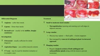Submandibular gland with applied aspects.pptx
