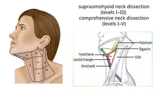 Comprehensive Surgical Guide to Submandibular Gland Resection and Neck ...