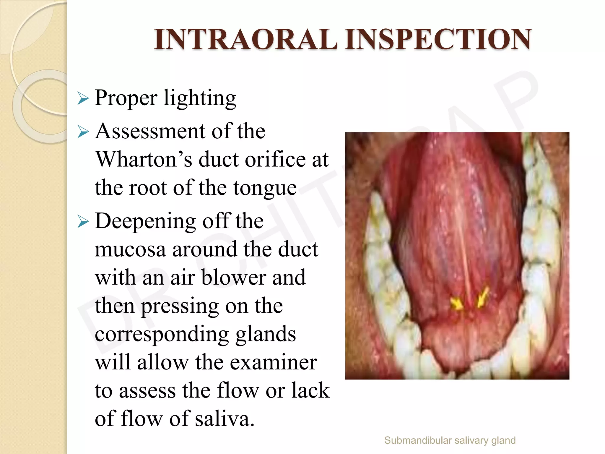 Submandibular salivary gland dr chithra | PPT