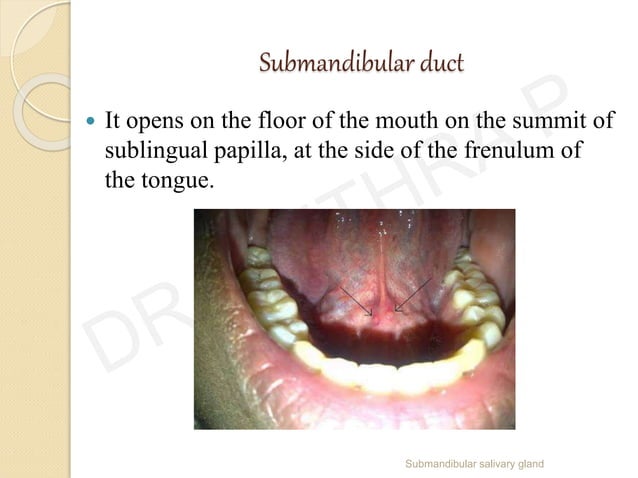 Submandibular salivary gland dr chithra | PPT