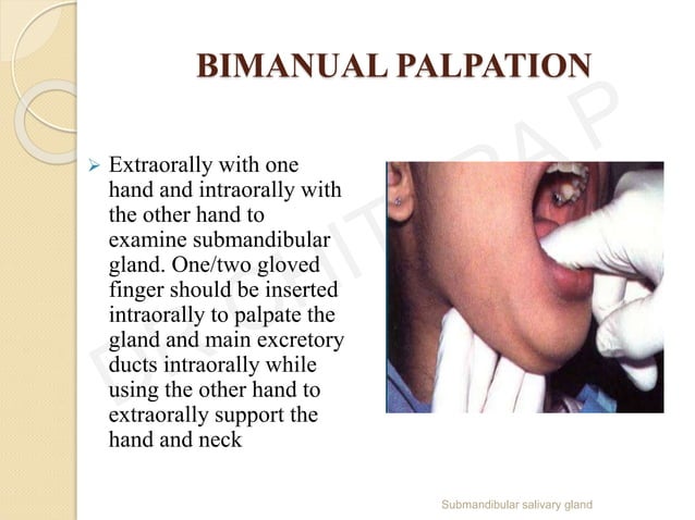 Submandibular salivary gland dr chithra | PPT