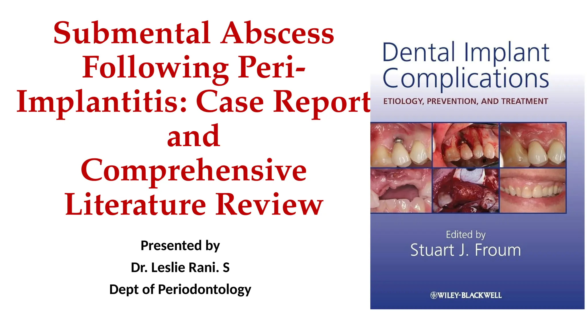 Submental Abscess Following Peri-Implantitis.pptx