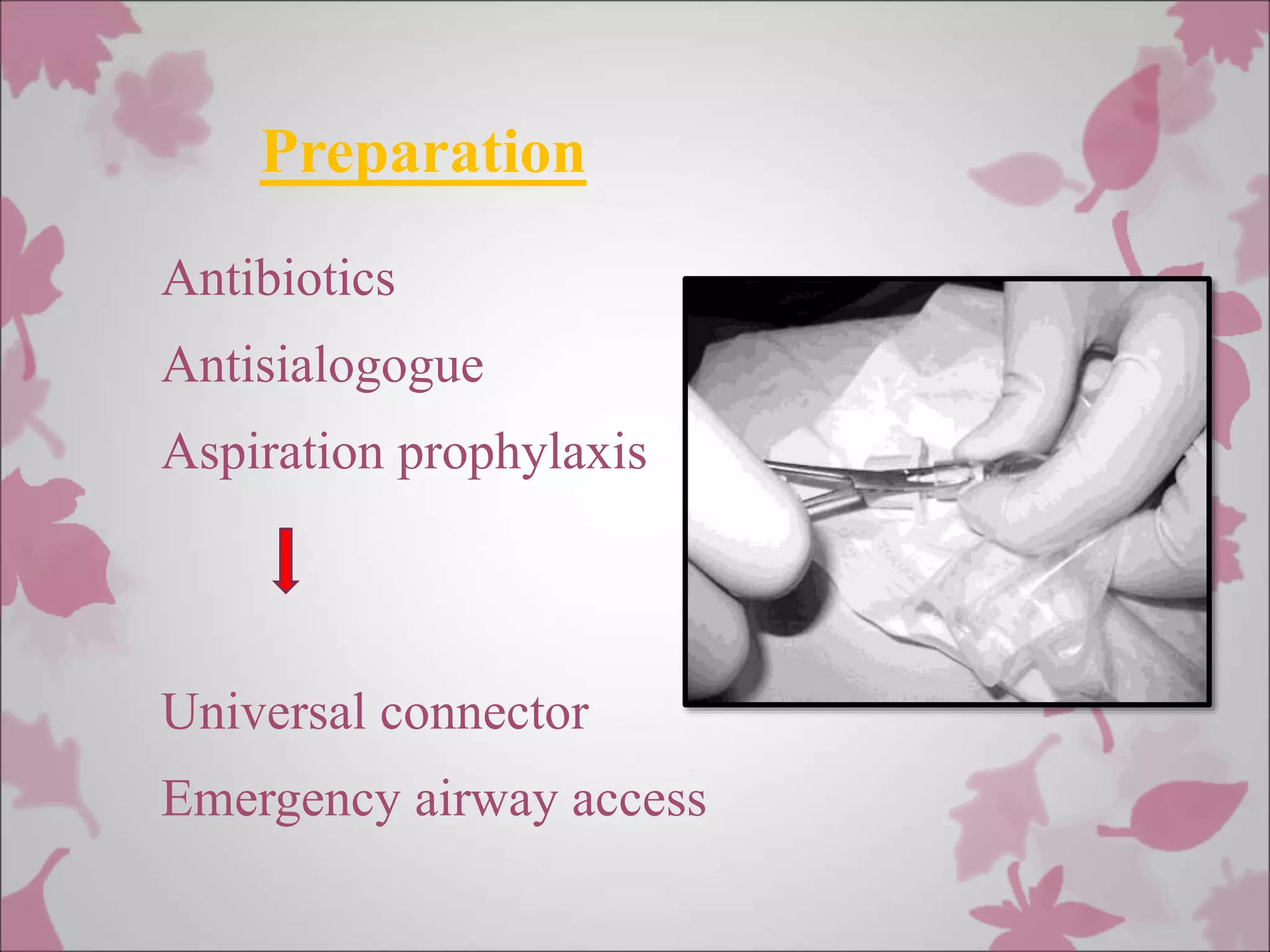 submental intubation.ppt