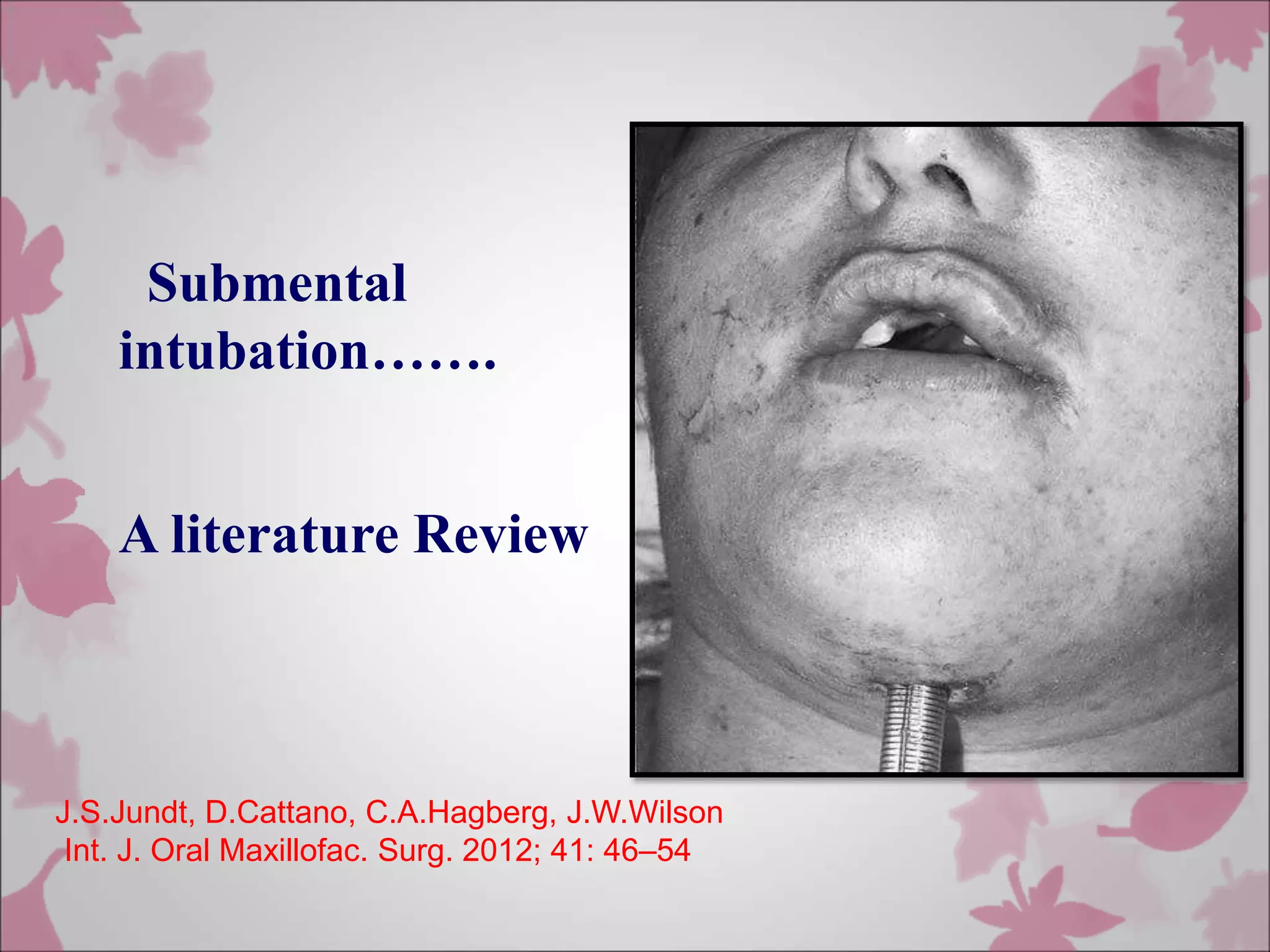 submental intubation.ppt