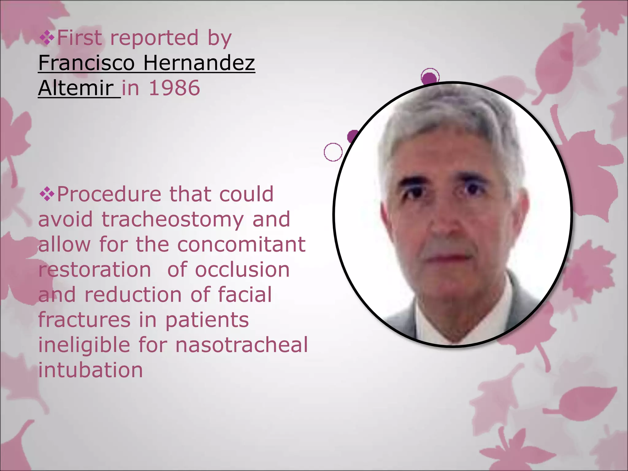 submental intubation.ppt