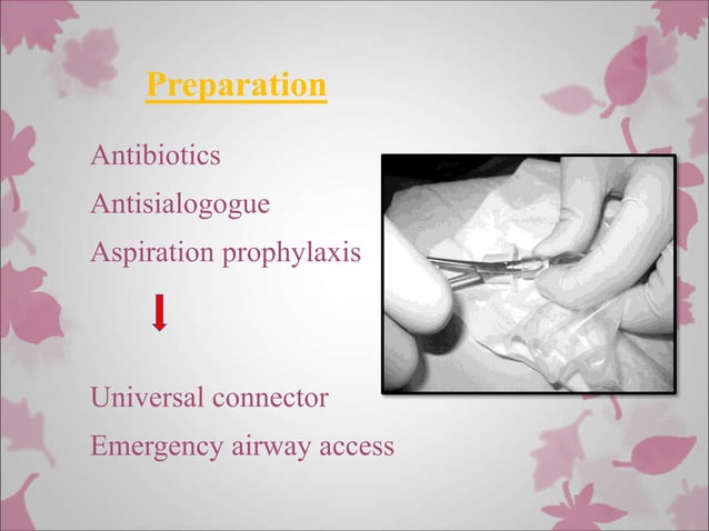 submental intubation.ppt | Ear, Nose and Throat Conditions | Diseases ...