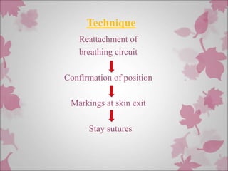 submental intubation.ppt