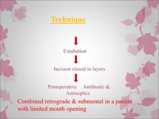 submental intubation.ppt