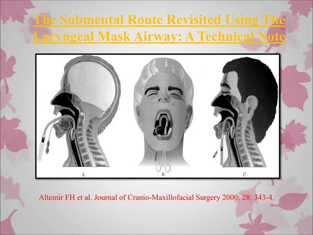 submental intubation.ppt | Ear, Nose and Throat Conditions | Diseases ...