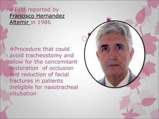 submental intubation.ppt