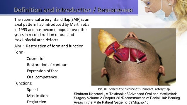 Submental island flap