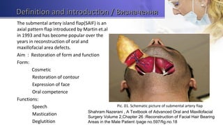 Submental island flap | PPT