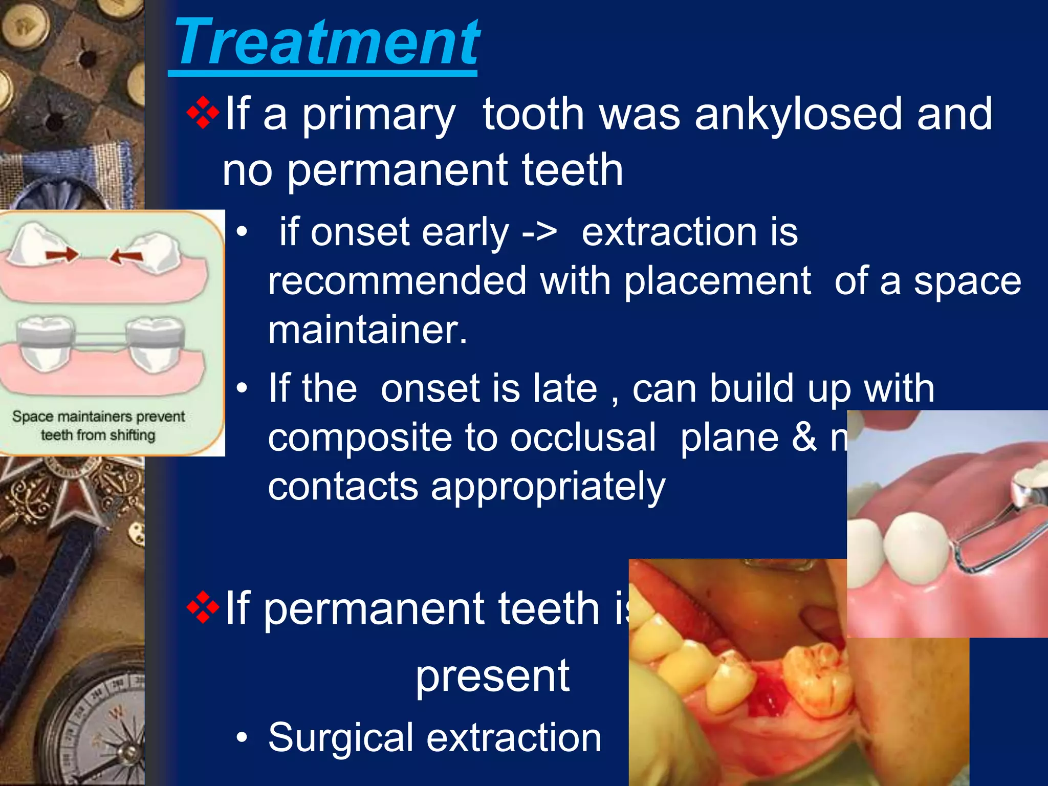 ankylosis of teeth | PPTX