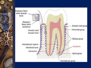 ankylosis of teeth | PPTX