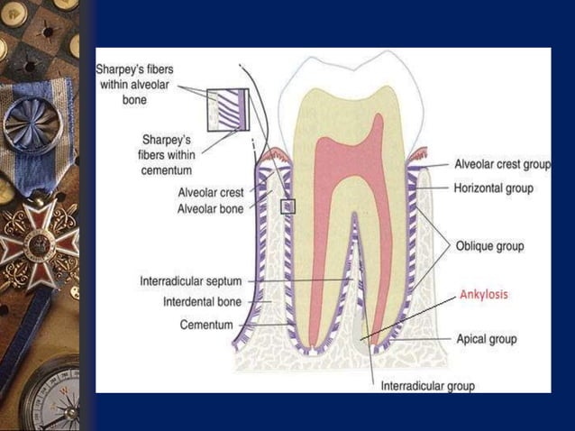 ankylosis of teeth | PPT