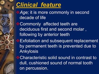 ankylosis of teeth | PPTX