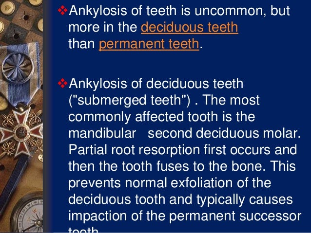 ankylosis of teeth
