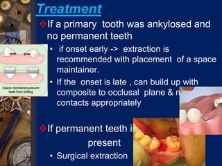 Submerged tooth | PPTX