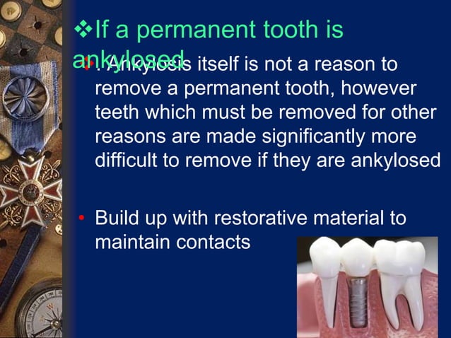 Submerged tooth | PPTX