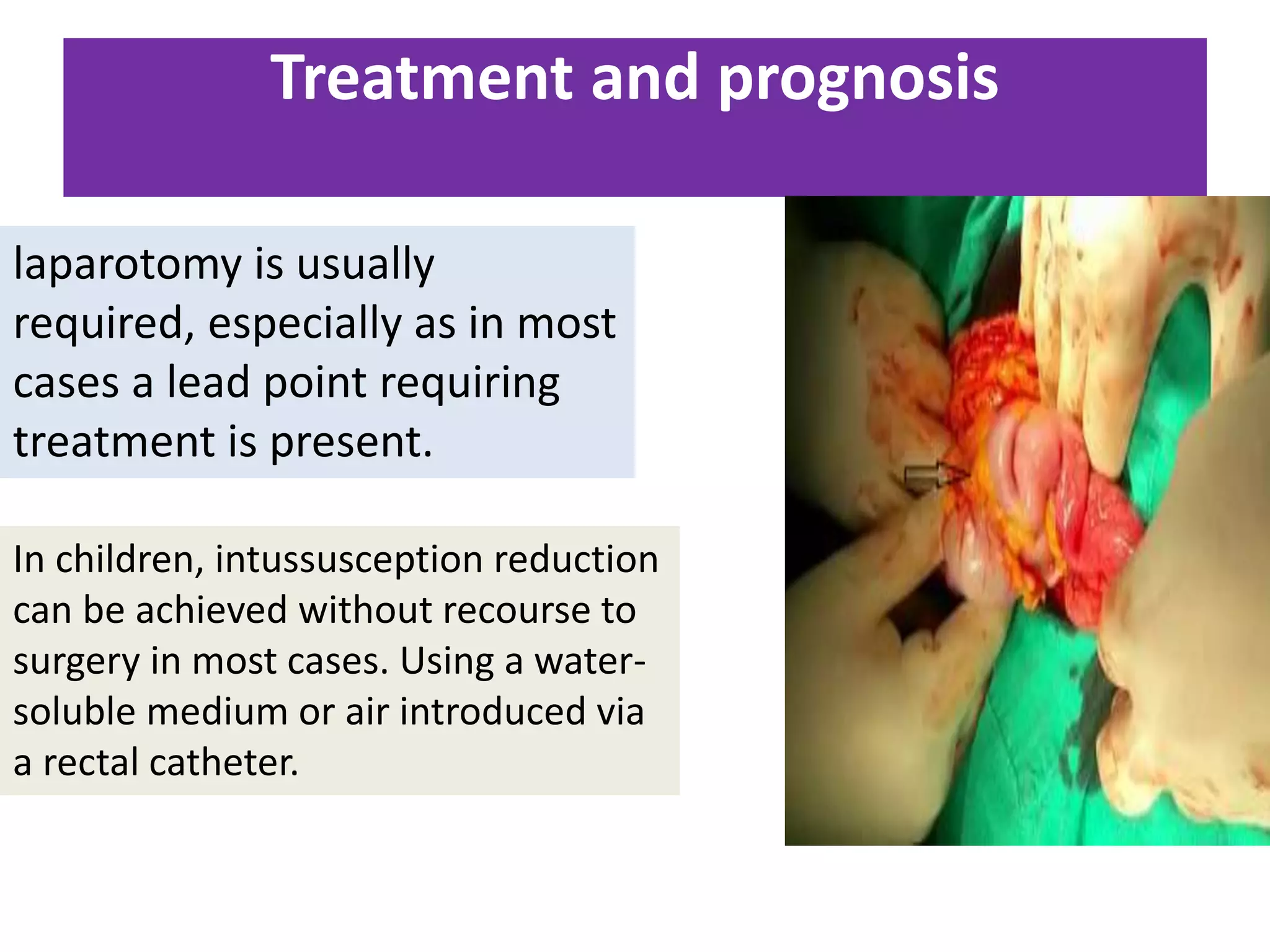 Intussusception in Adults-Submucosal Lipoma at Transverse colon-A rare ...