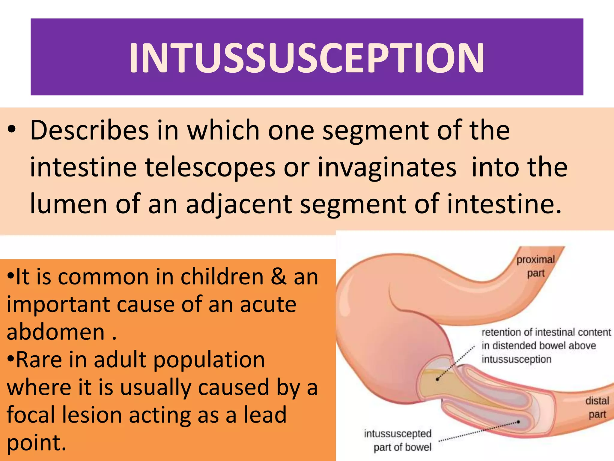 Intussusception in Adults-Submucosal Lipoma at Transverse colon-A rare cause | PPT | Free Download