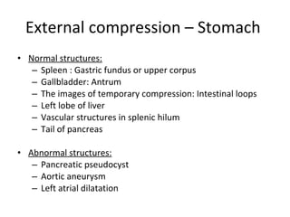 Subepithelial lesions | PPT
