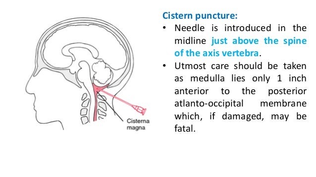 Suboccipital region and muscles of back