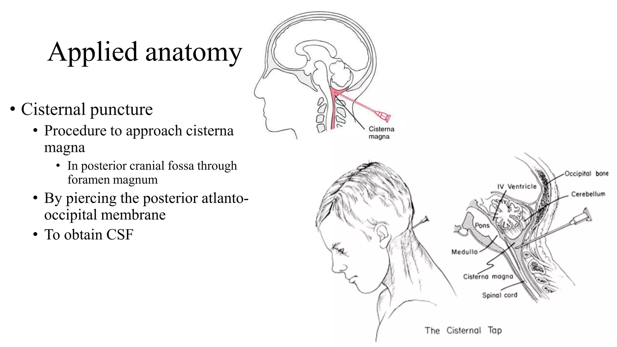 Suboccipital triangle | PDF