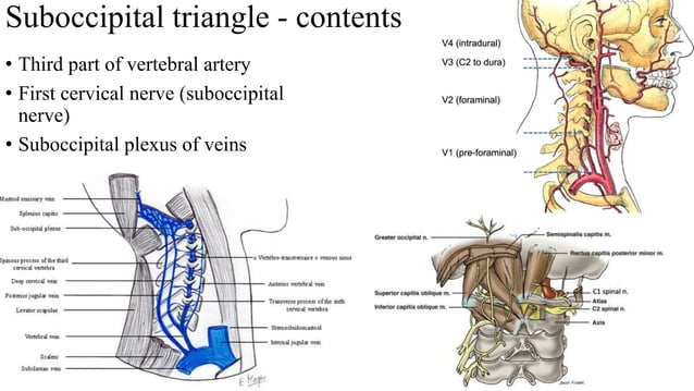Suboccipital triangle