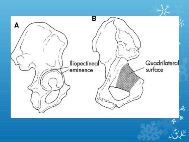 Subodh acetabulum ppt