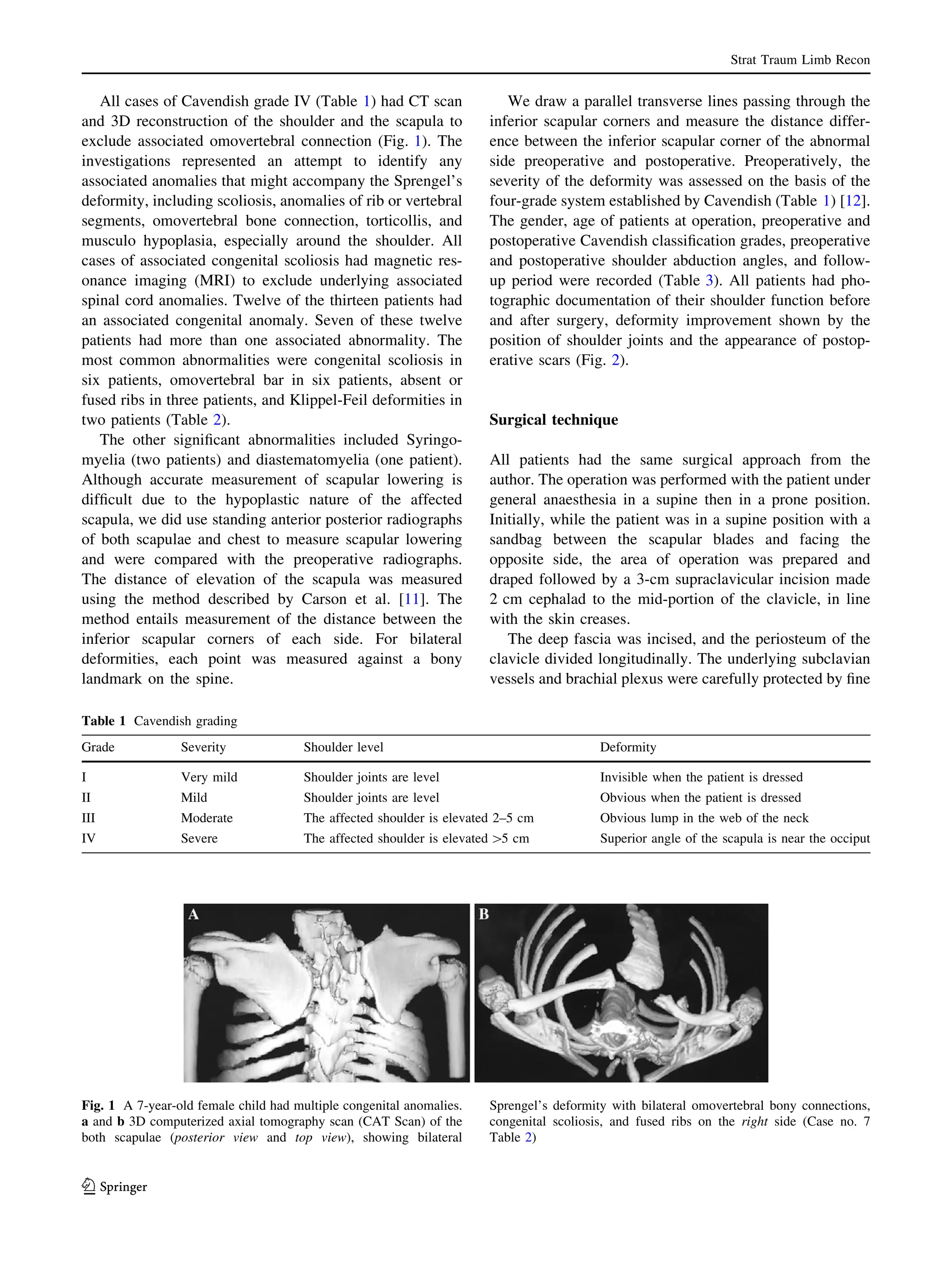 Subperiosteal resection of mid-clavicle in sprengel's.pdf