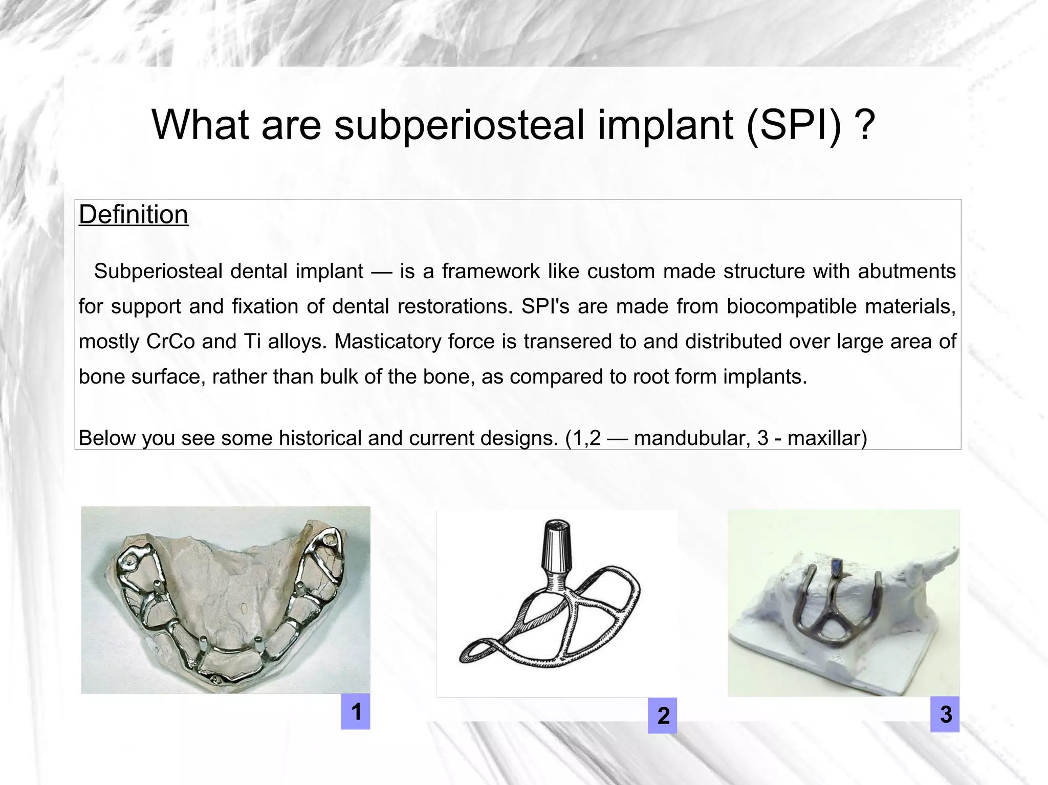 Introduction to subperiosteal implants | ODP