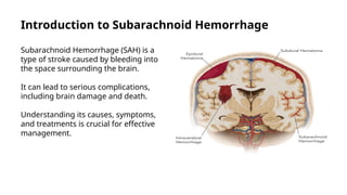Subracanoid Hemorahge.pptx for neurological | PPT