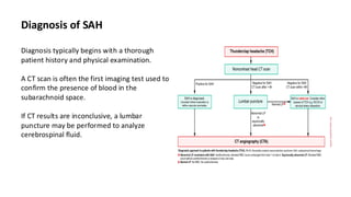Subracanoid Hemorahge.pdf for neurological | PPT