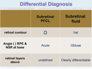Subretinal perfluorocarbon liquid case report | PPT