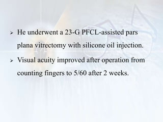 Subretinal perfluorocarbon liquid case report | PPTX