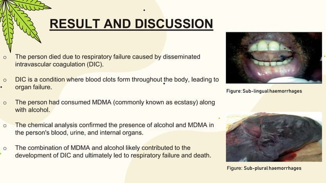 Substance of Abuse : Case studies and review. | PPTX | Illegal Drugs ...